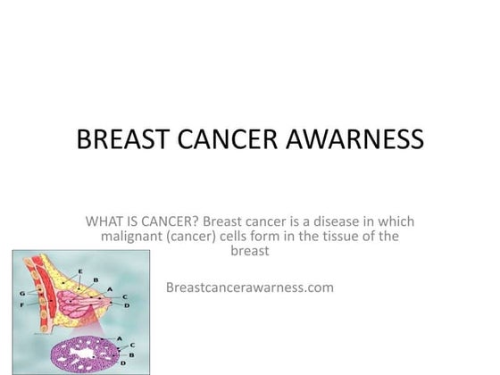 Breast Cancer – Types, Causes, Symptoms and Prevention | PDF