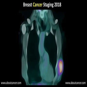 Breast cancer staging 2018 video power points | PPT