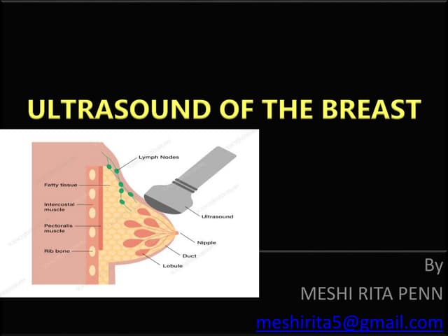 Breast Ultrasound Pptx