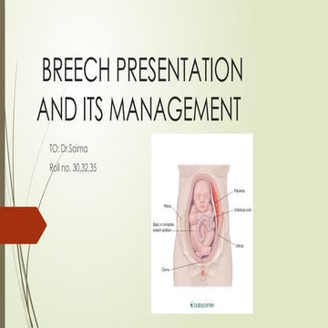 BREECH PRESENTATION.pptx very good present | PPT