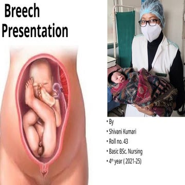 Breech Presentation.pptx3578668964367884 | PPTX