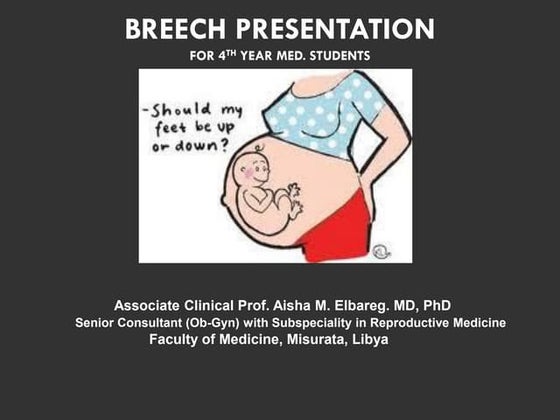 Breech mech of labour | PPT