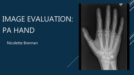 Basic and supplementary projection of hand | PPT