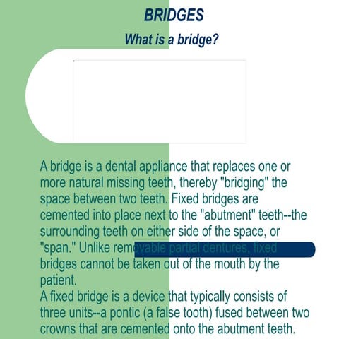 Different Types of Dental bridges - Green Valley Smile Care.pptx