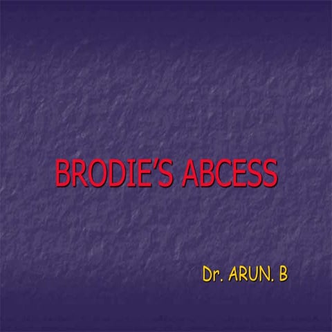 Brodie's abcess | PPT