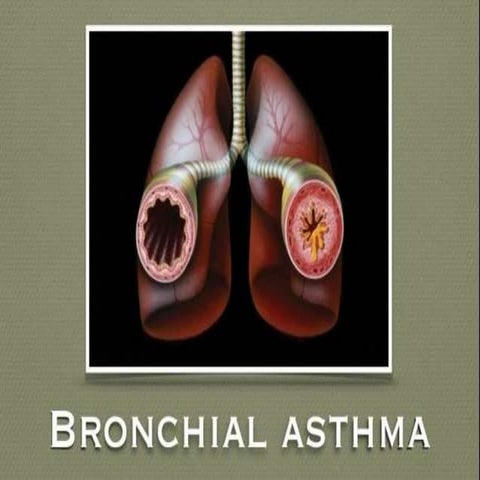 bronchial asthma for mbbs students and pgs students.pptx