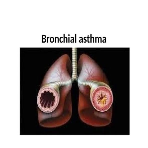 Bronchial asthma.power point presentation | PPTX