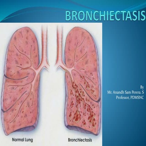 bronchiectasis.pptx