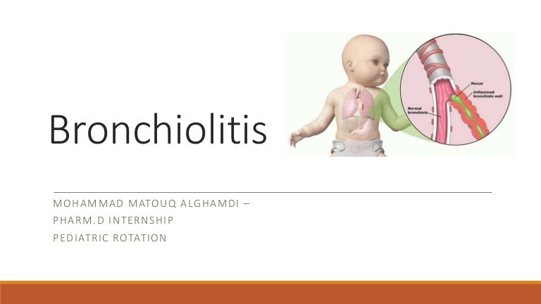 Bronchiolitis | Case Study