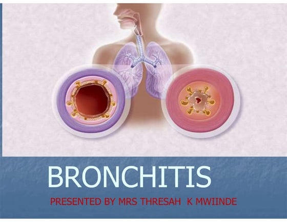 Chronic bronchitis | PPT