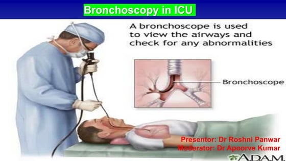 Ebus Bronchoscopy blog | PDF