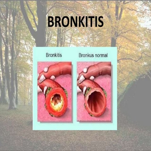 Bronkitis ppt | PPTX