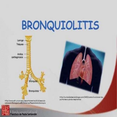 Bronquiolitis | PPTX