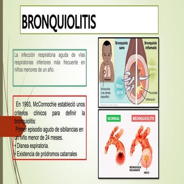 Bronquiolitis Pptx