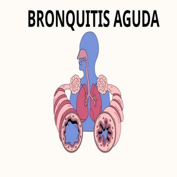 BRONQUITIS AGUDA.pptx