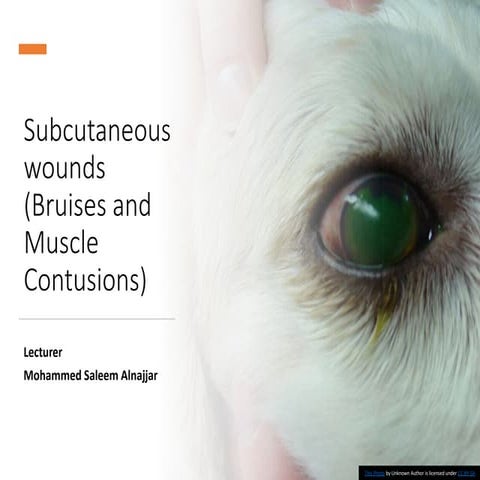 Subcutaneous wounds bruises and Contusions .pptx | First Aid | Injuries