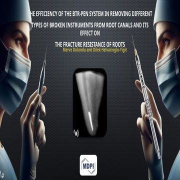 File Retrieval in Endodontics - BTR Pen. | PPTX