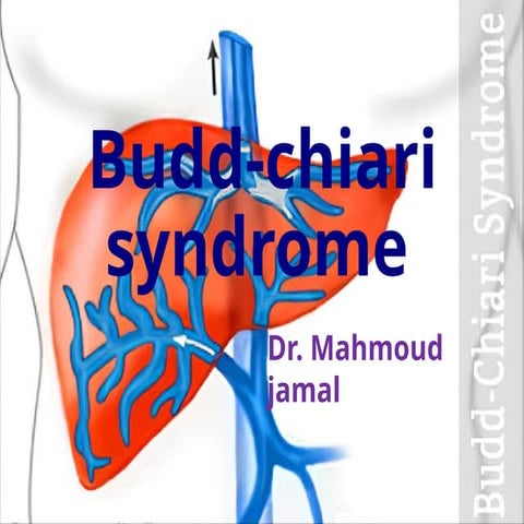 Budd chiari syndrome by Dr. Mahmoud jamal | PPT