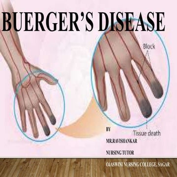 Buerger’s disease.pdf