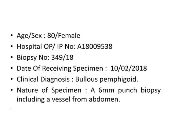 Graft versus host disease | PPT