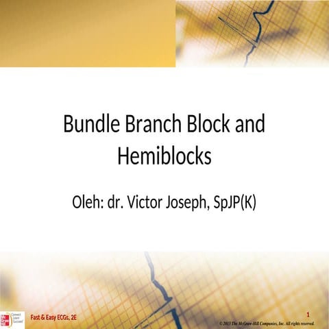 Bundle Branch Blockss in Arrhythmias.ppt