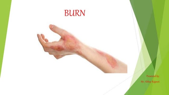 Burn | PPT