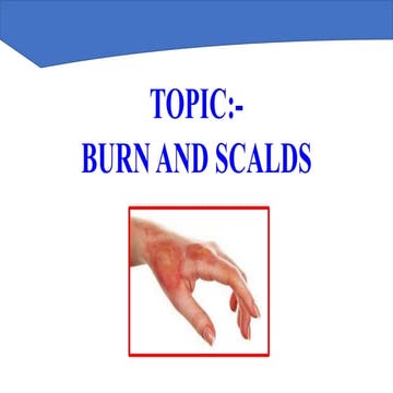 Understanding Burns: A Comprehensive Overview" | PPTX