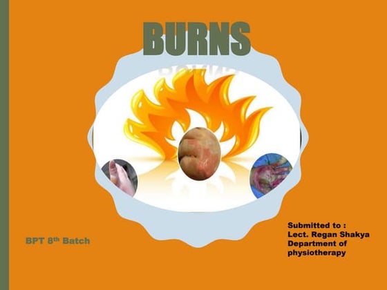 Burn | PPTX