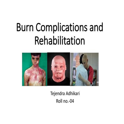 Burn complications and rehabilitation | PPTX