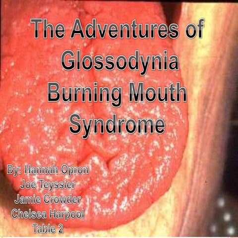 Burning mouth syndrome | PPTX