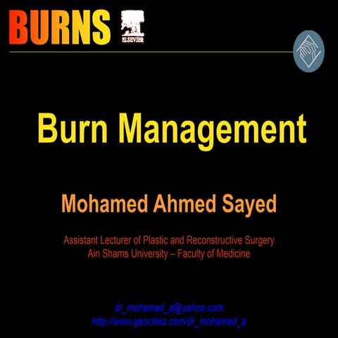 Burn management | PPT