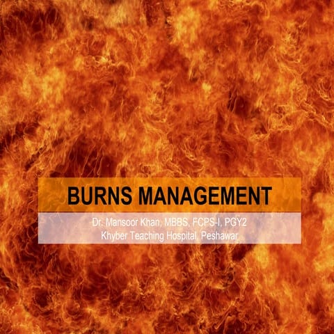 Burns | PPT