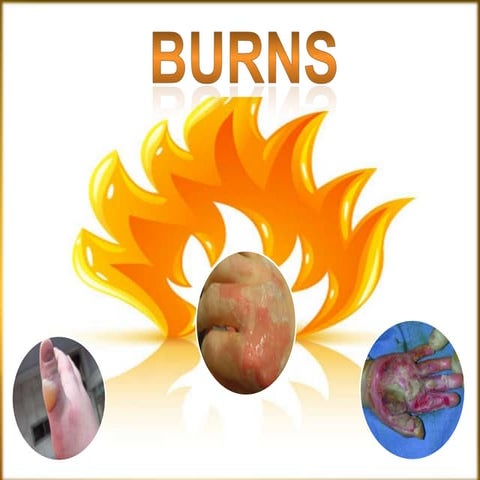 Burns | PPTX