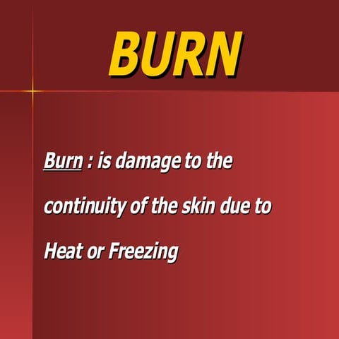 Burns | PPT
