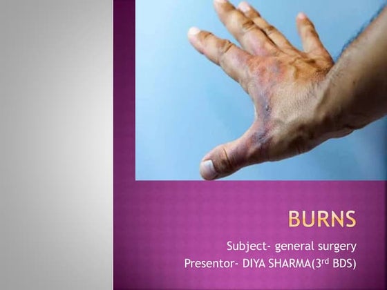 Burn | PPT