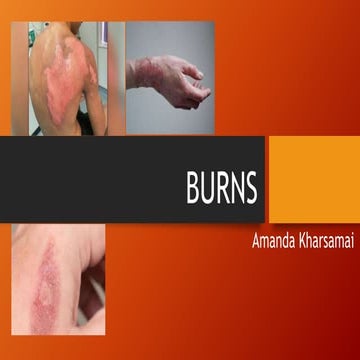 BURNS.pptx | First Aid | Injuries