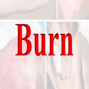 Burns.pptx