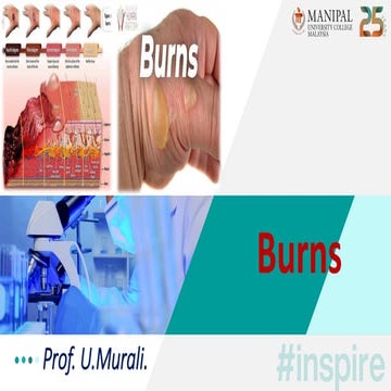 Burns - Types, Clinical Features & Management | PDF