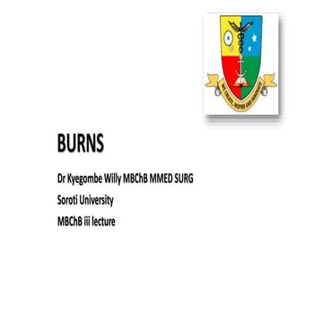 Burns Pptx