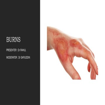 Burn | PPTX