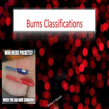Burns; Types, Management, Treatment and Causes | PPSX