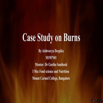 CASE STUDY ON BURNS | PPTX