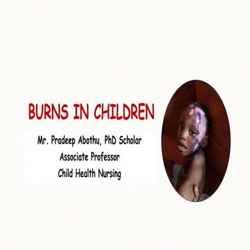 BURNS IN CHILDREN: THERAPEUTIC MANAGEMENT.pptx