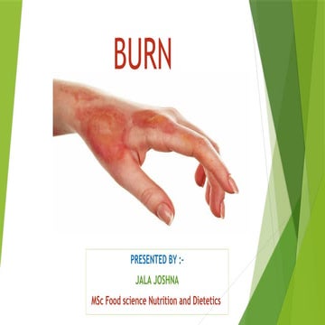 Burns presentation. | PPT