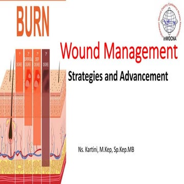 Burn Wound Management 21.pdf