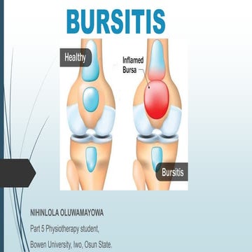 Bursitis | PPTX