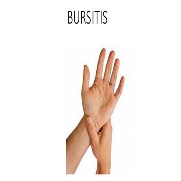 Bursitis mano | PDF