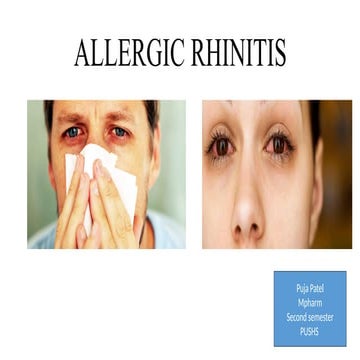 presentation of allergic rhinitis by puja | PPTX