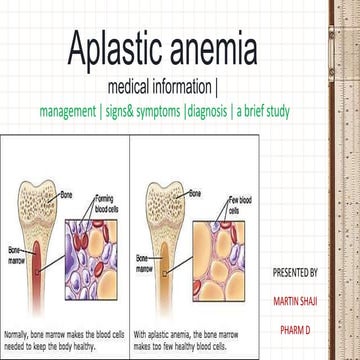 Aplastic anemia