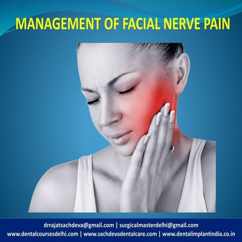 Trigeminal Neuralgia| Management of Facial Pain | PPTX